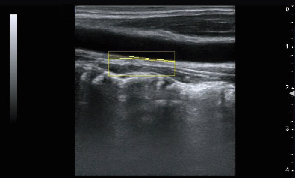 Advanced Design Full Digital Color Doppler Ultrasound System - Narula ...