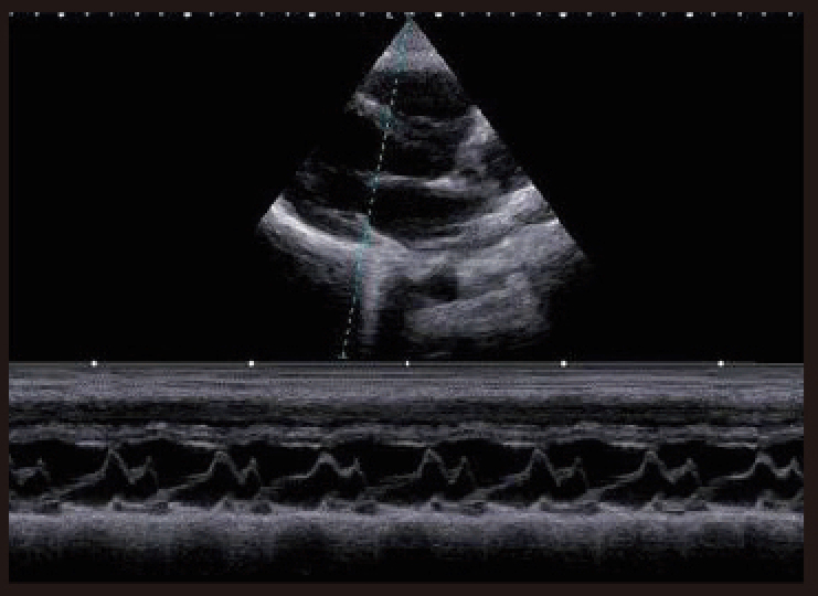 Advanced Design Full Digital Color Doppler Ultrasound System - Narula ...