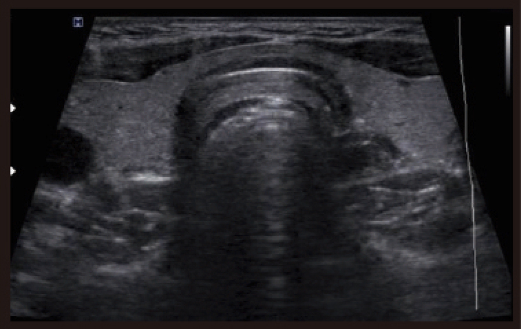 Advanced Design Full Digital Color Doppler Ultrasound System - Narula ...