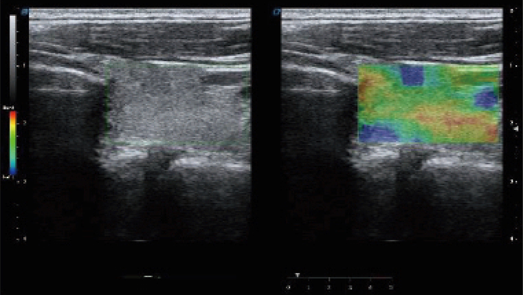 Advanced Design Full Digital Color Doppler Ultrasound System - Narula ...