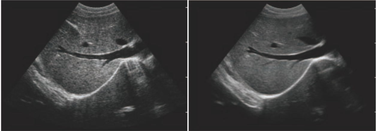 Advanced Cardiac Ultrasound Scan Machine - Narula Exports